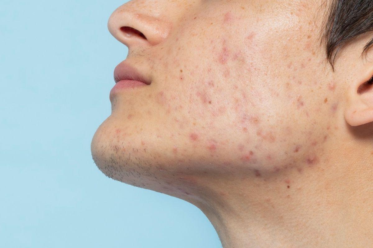 Panduan Lengkap Perm Rambut Pria: dari Tren hingga Perawatan